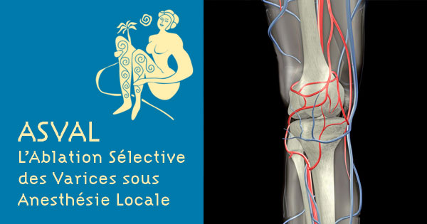 ASVAL - Riviera Veine Institut